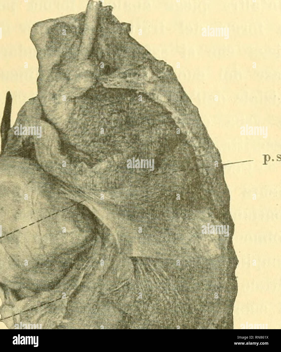 Pericardio fibroso hi-res stock photography and images - Alamy