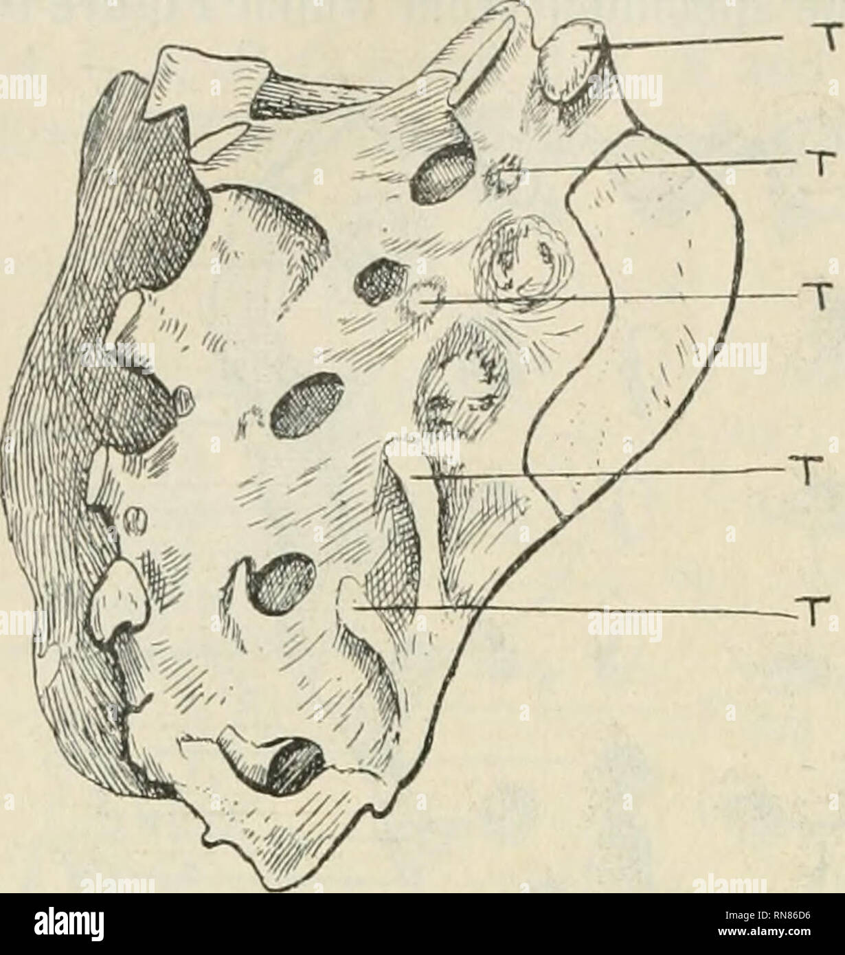Sacral tuberosity hi-res stock photography and images - Alamy