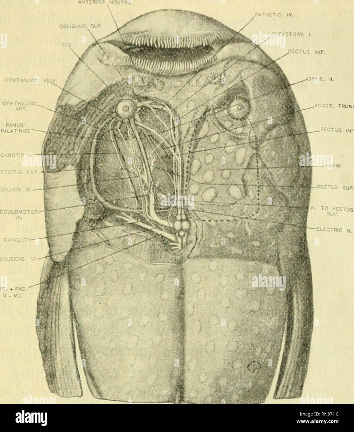 Dissected carotid artery hi-res stock photography and images - Alamy