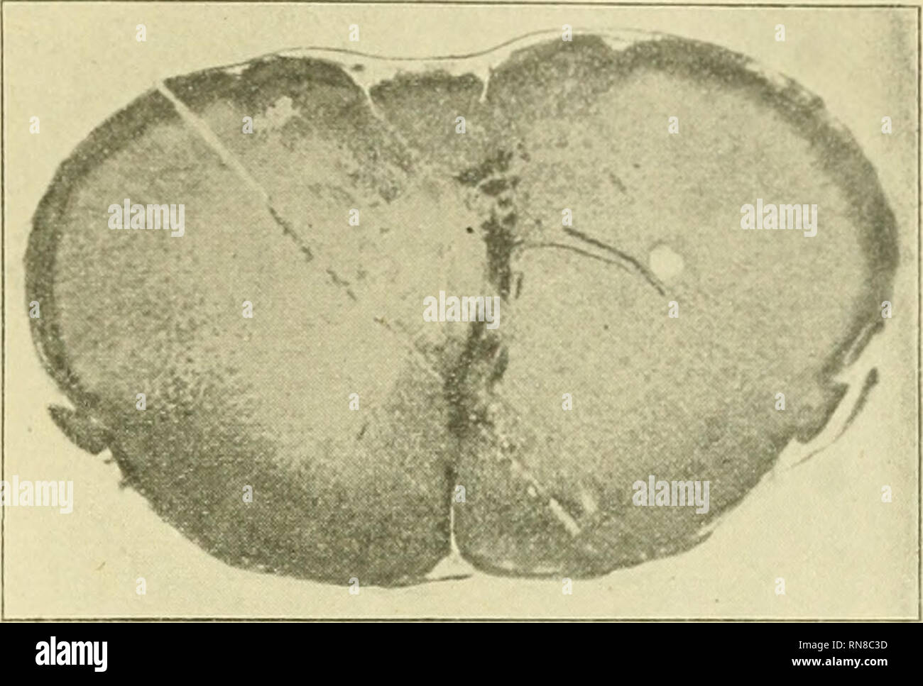 Formatio reticularis hi-res stock photography and images - Alamy