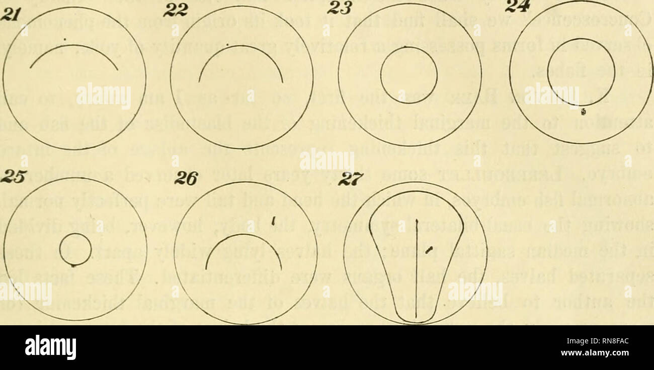 Cephalic position hi-res stock photography and images - Alamy