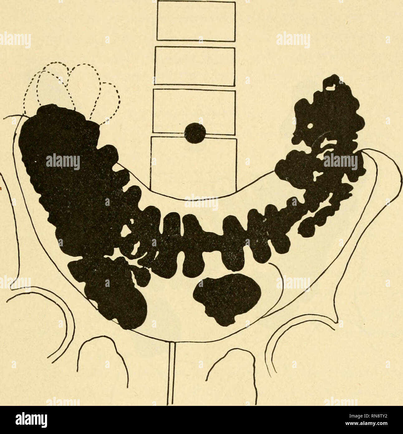 . Anatomische Hefte. über den Bau und die Entstehung der Haustra coli ...