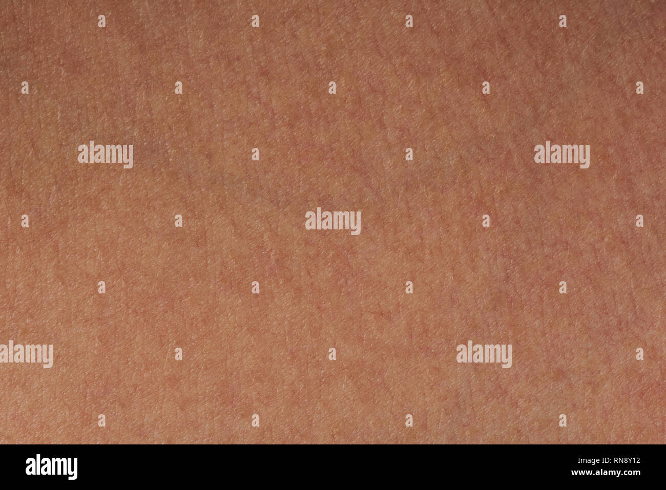 Flat skin pattern. Texture of human skin Stock Photo - Alamy
