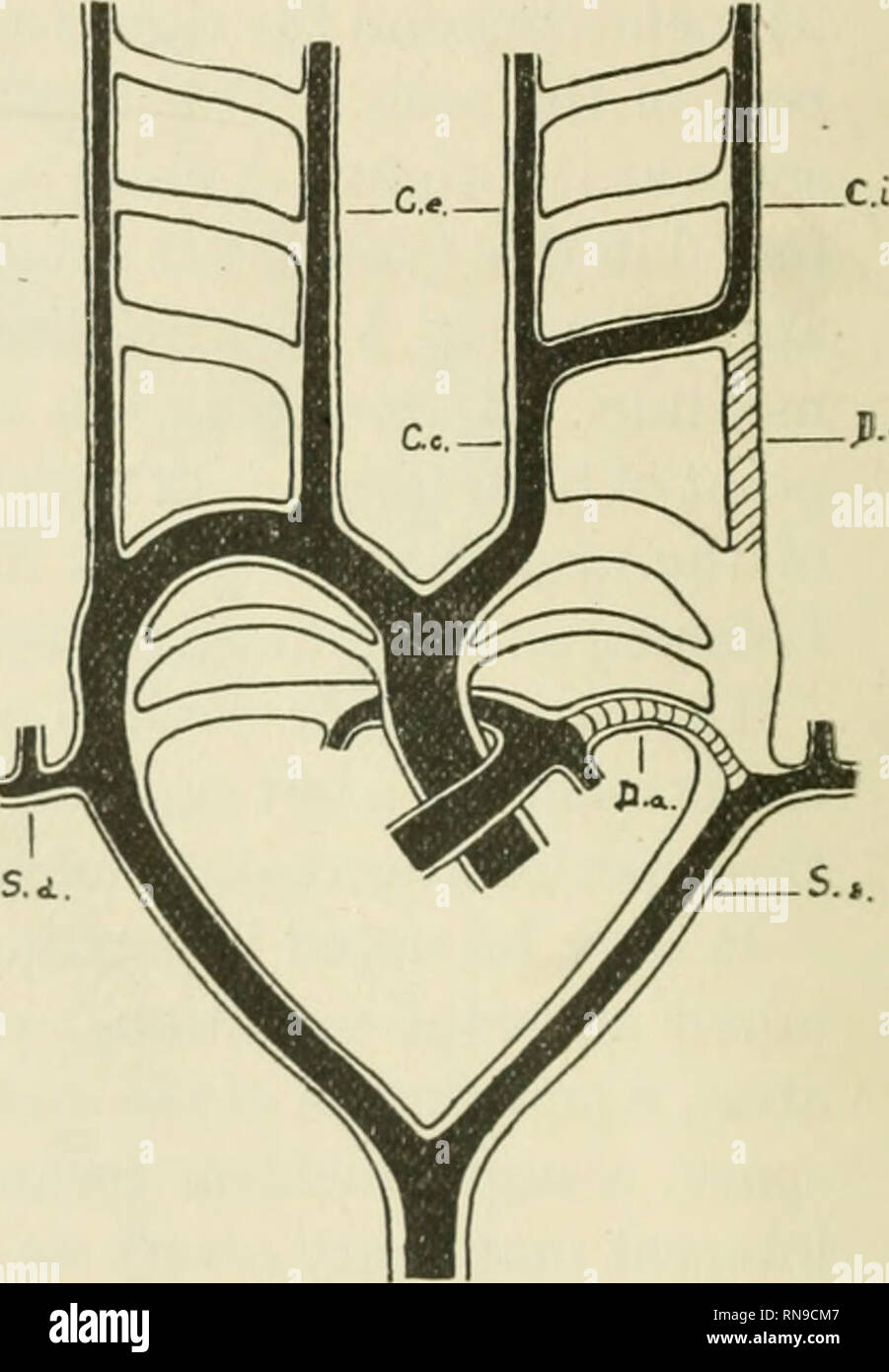 Ductus Arteriosus Ligamentum Arteriosum