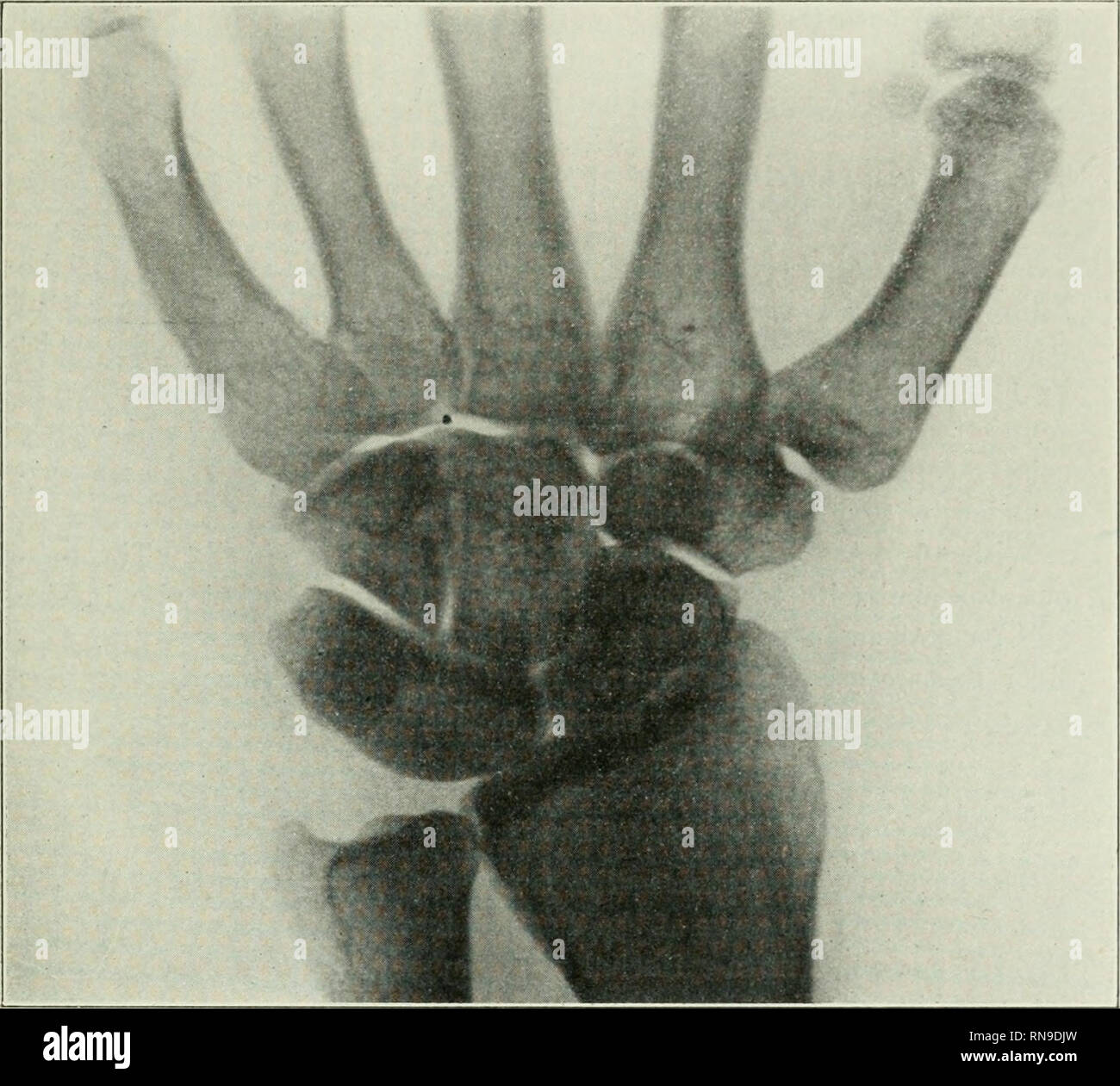 . The anatomical record. Anatomy; Anatomy. The Anatomical IJocord. 145 ...