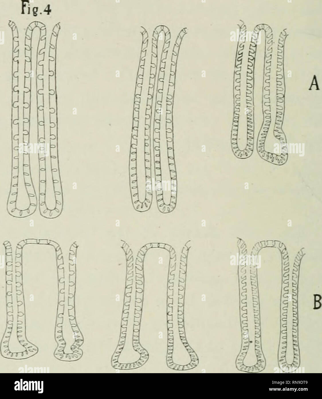 Large intestine camera hi-res stock photography and images - Alamy