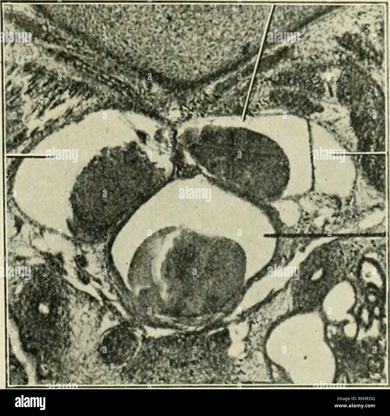 Division intima hi-res stock photography and images - Alamy