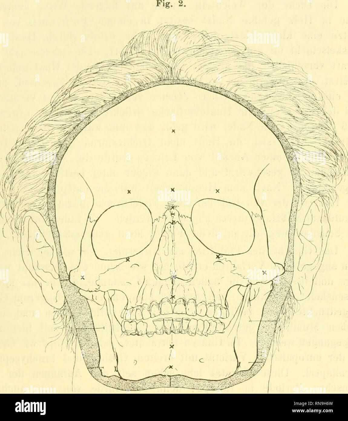 Diese lippen hi-res stock photography and images - Alamy