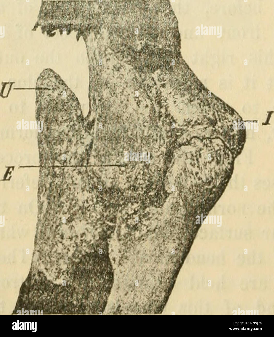 Olecranon fossa hi-res stock photography and images - Alamy