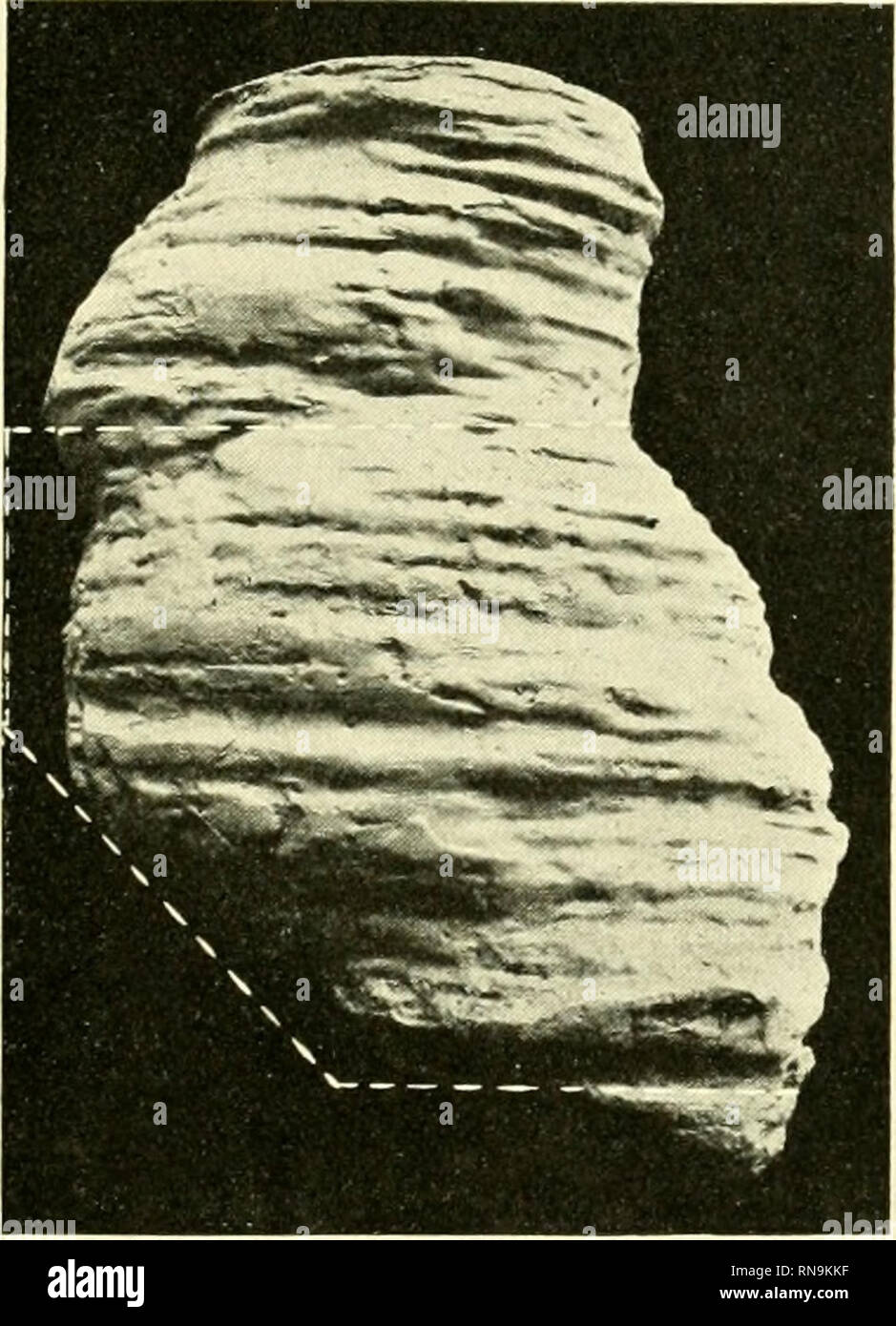 Ampulla recti hi-res stock photography and images - Alamy