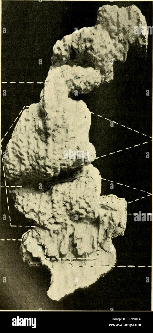 Ampulla recti hi-res stock photography and images - Alamy