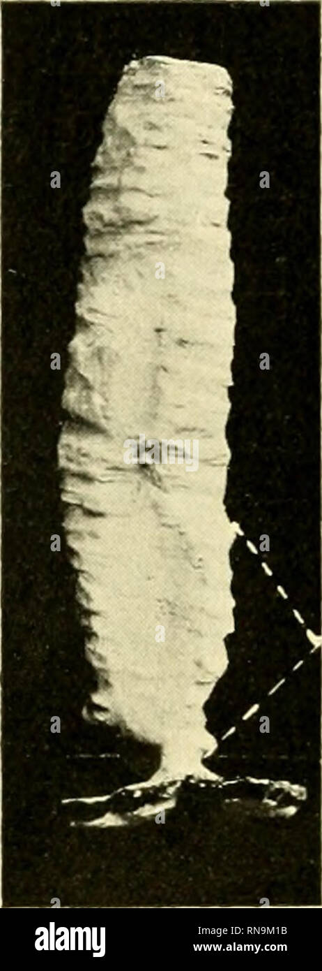 Ampulla recti hi-res stock photography and images - Alamy