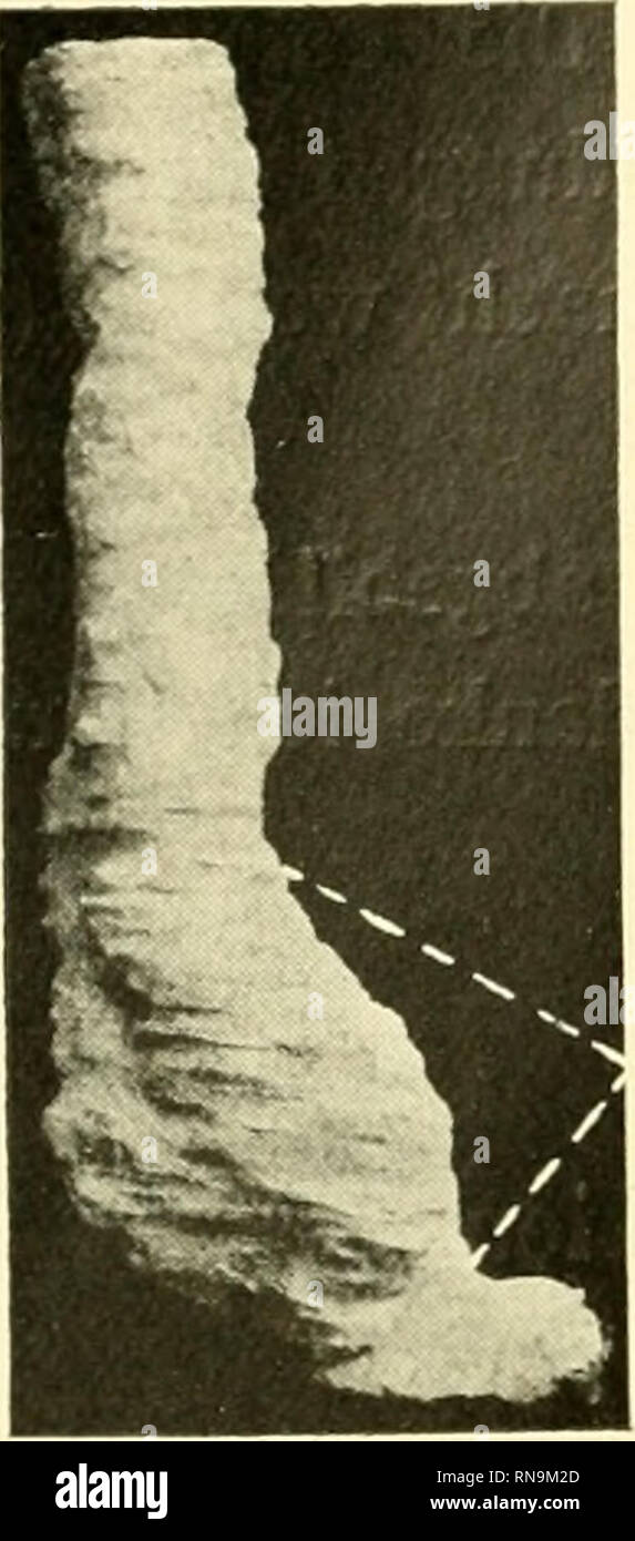 Ampulla recti hi-res stock photography and images - Alamy