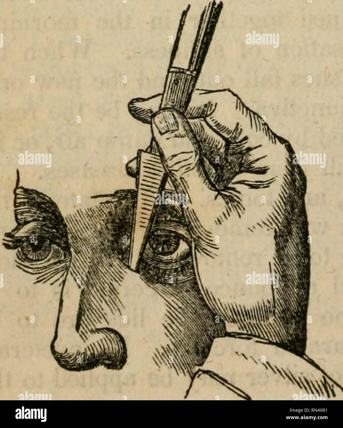 Eyelid eversion hi-res stock photography and images - Alamy