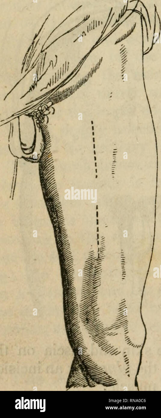 . An analytical compendium of the various branches of medical science ...