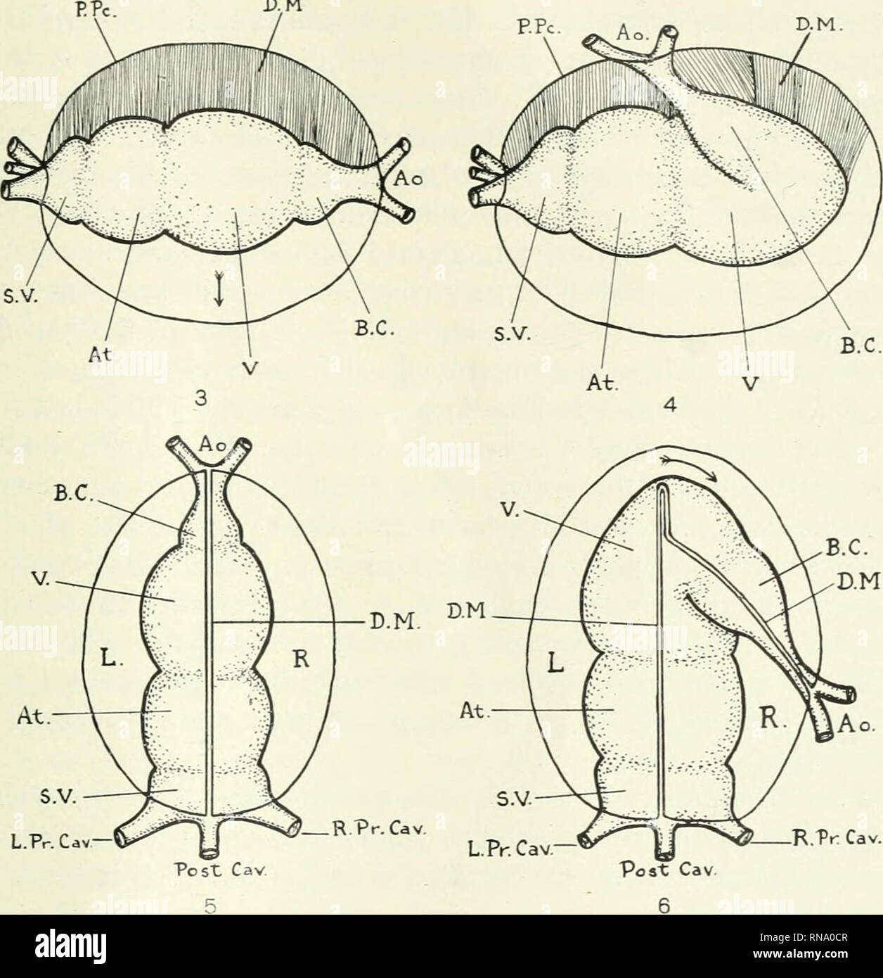 Pericardial cav hi-res stock photography and images - Alamy