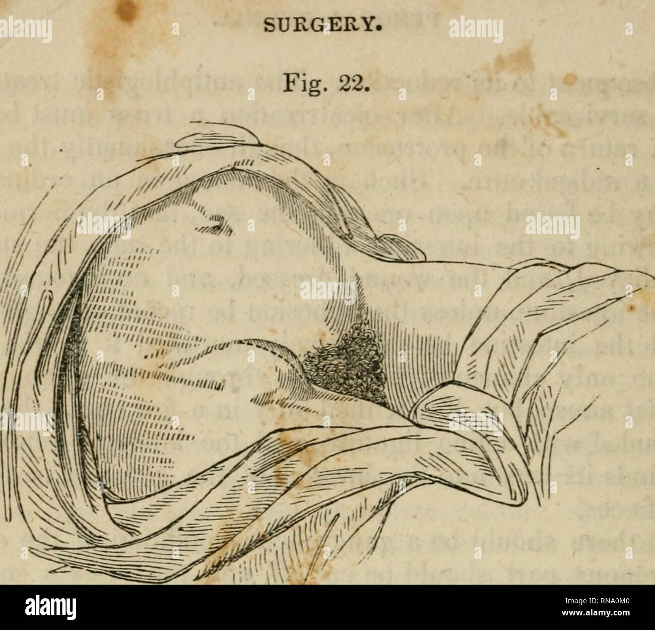 Pinched Skin High Resolution Stock Photography and Images - Alamy