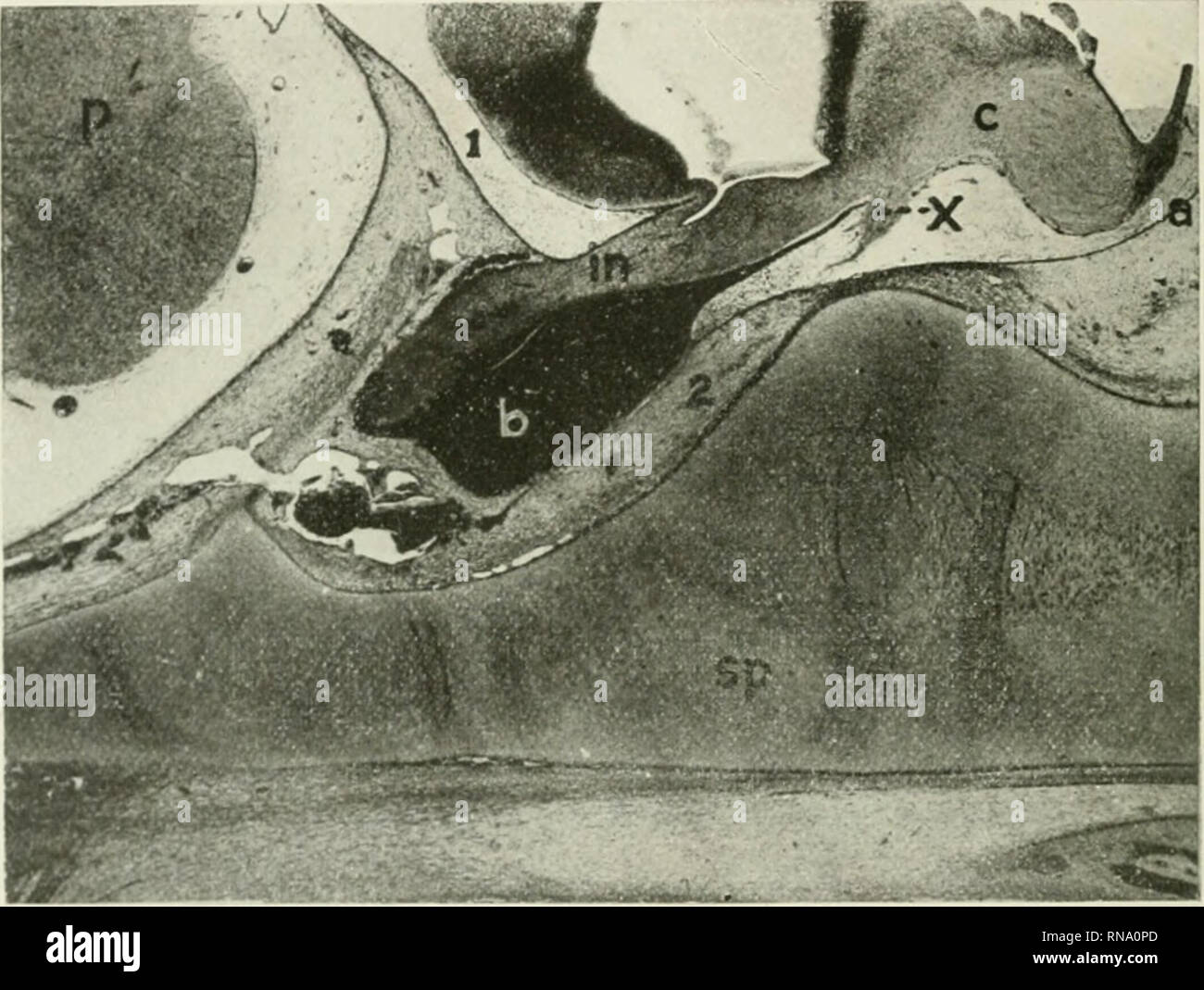 Midline sagittal section hi-res stock photography and images - Alamy