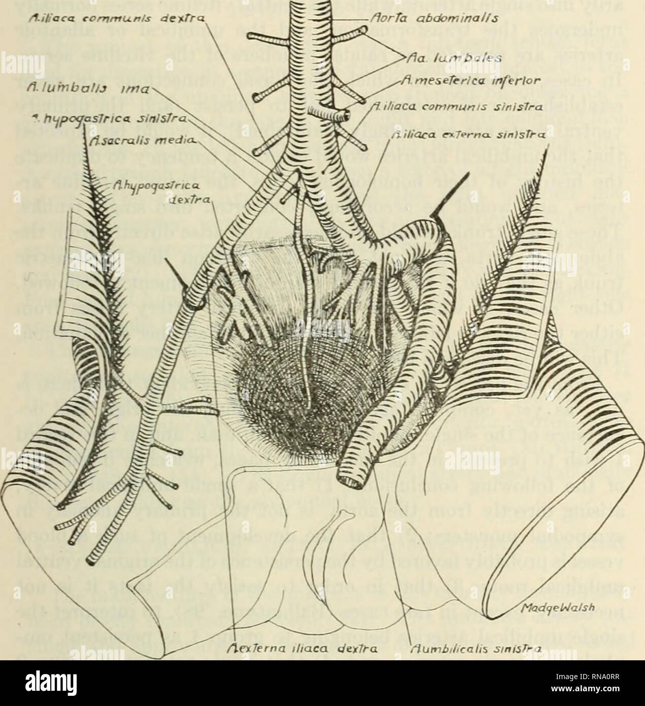 Umbilical Arteries