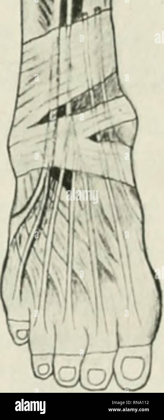 Foot anatomy tendons ligaments hi-res stock photography and images - Alamy