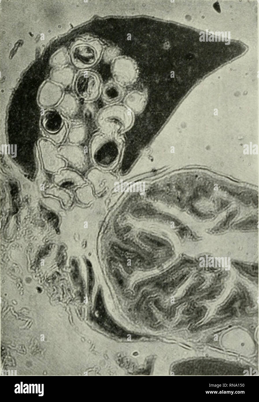 Hermaphroditism In Humans Images