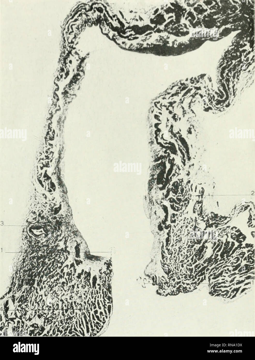 . The anatomical record. Anatomy; Anatomy. NODE AM) AIAKS I. TIIK IHMAX ...