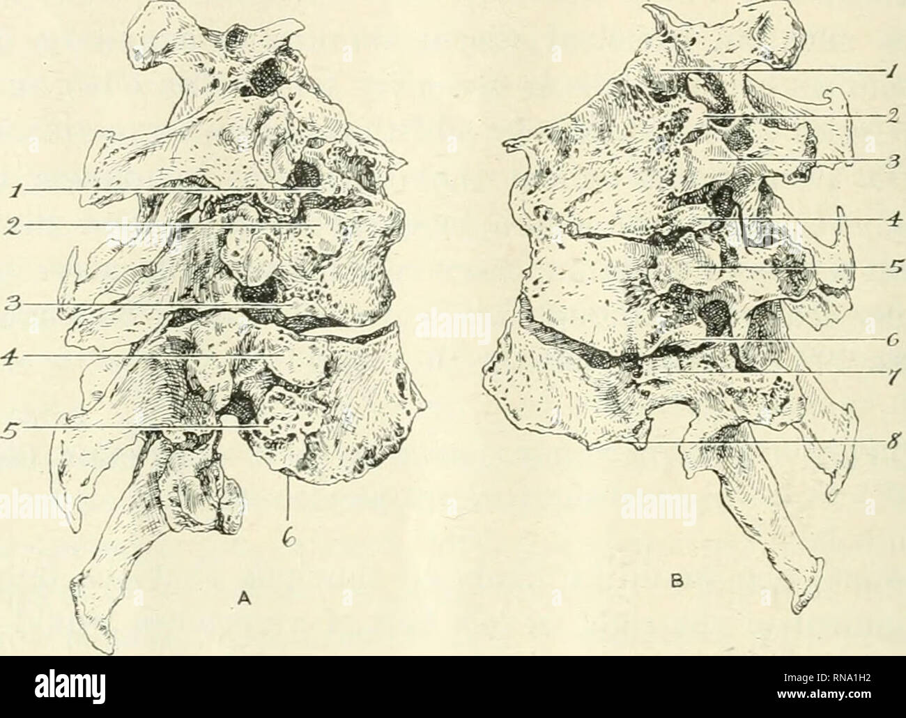 Eighth thoracic vertebra hi-res stock photography and images - Alamy