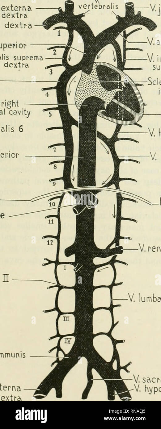Thrombus atrium hi-res stock photography and images - Alamy