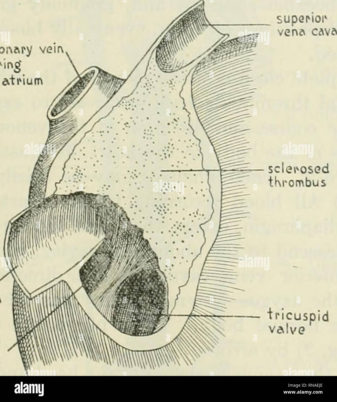 . The anatomical record. Anatomy; Anatomy. COMPLETE OCCLUSION OF MOUTH ...