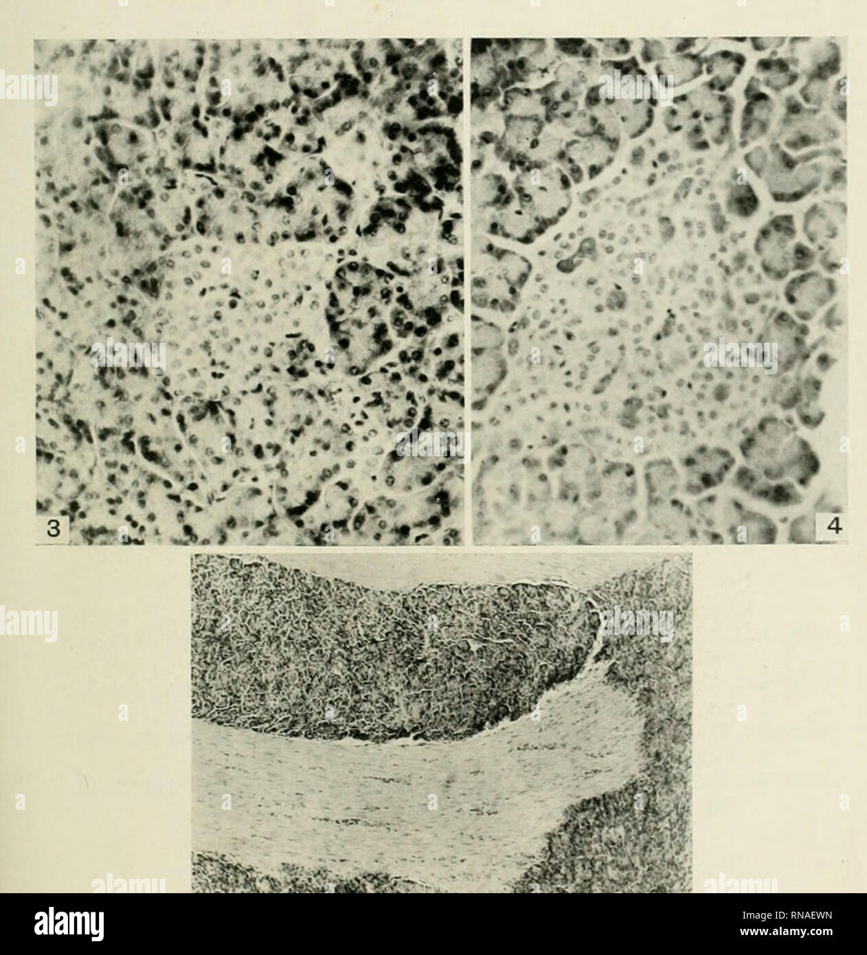 Smooth muscle photomicrograph hi-res stock photography and images - Alamy
