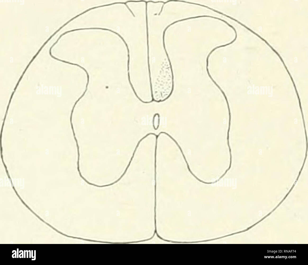 Posterior median septum hi-res stock photography and images - Alamy