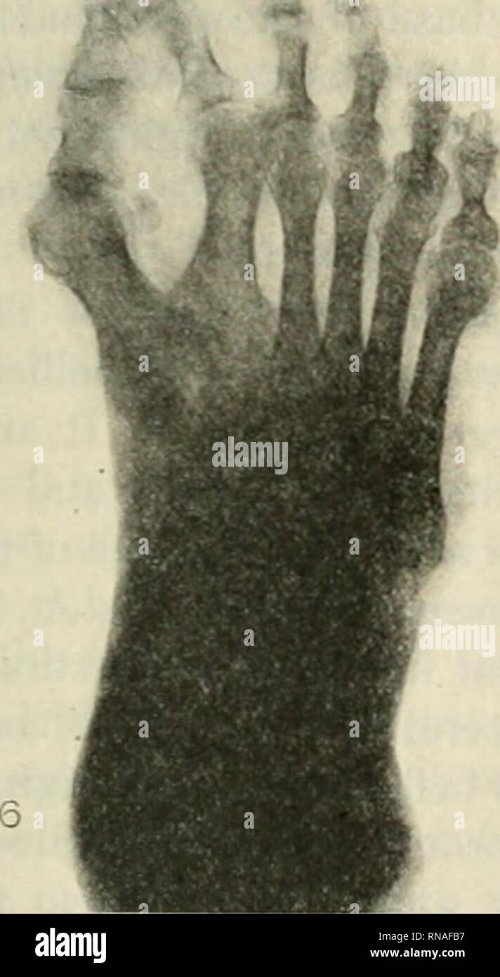 . The Anatomical record 1922-1923. Anatomy. *«* ^. Fig. 5 Skiagram of ...