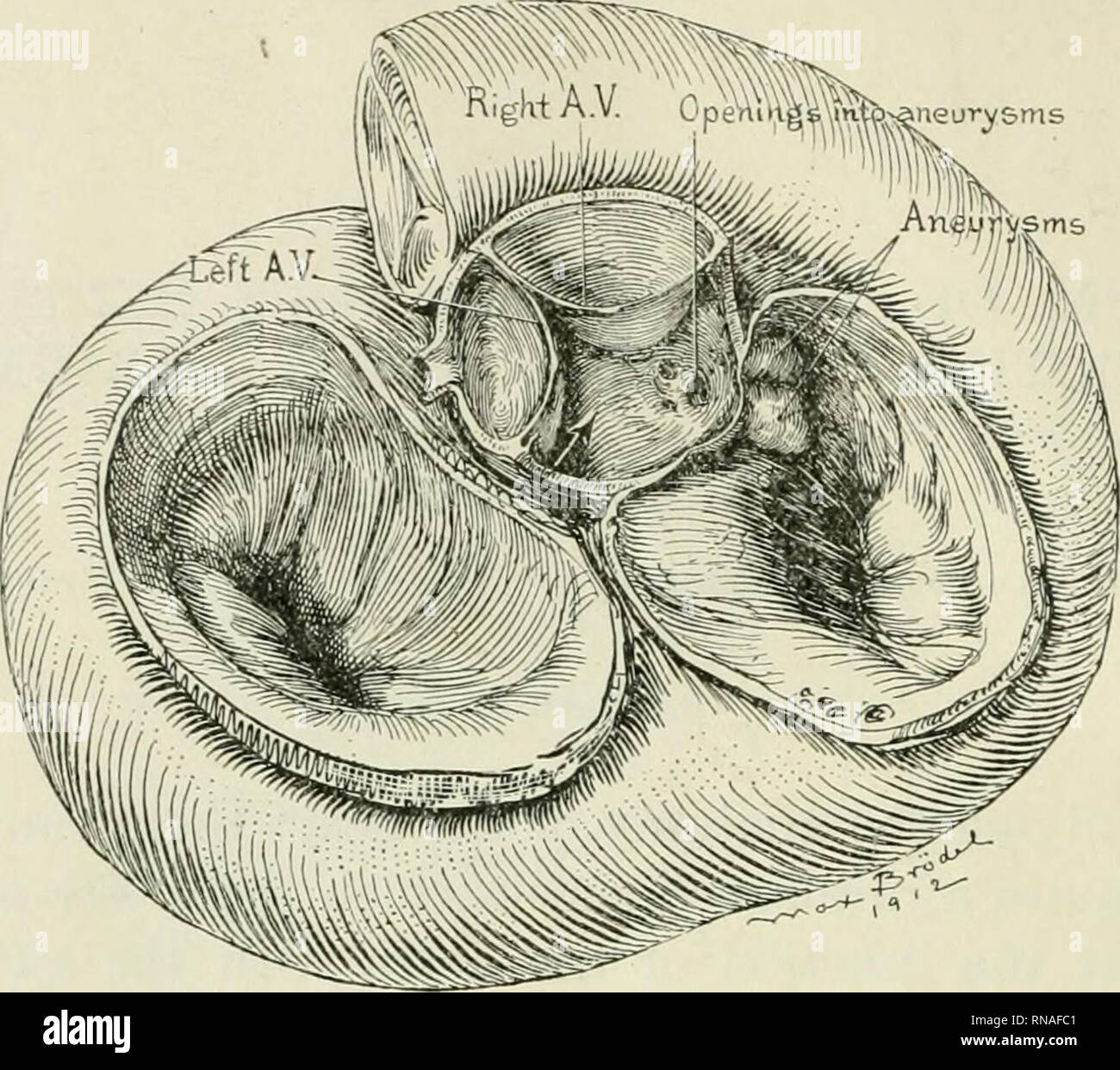 Semi lunar valve hi-res stock photography and images - Alamy