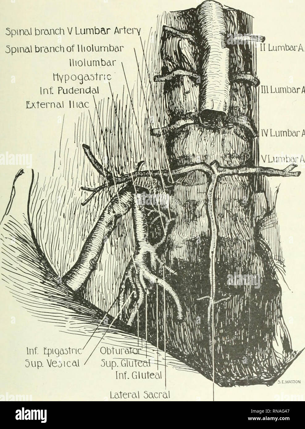 Lumbar Artery