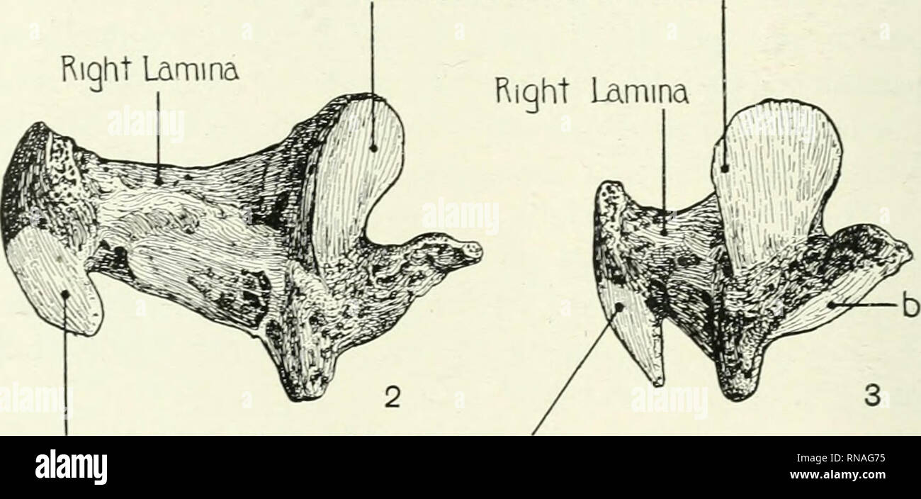 . The anatomical record. Anatomy; Anatomy. Superior Articular Process v ...