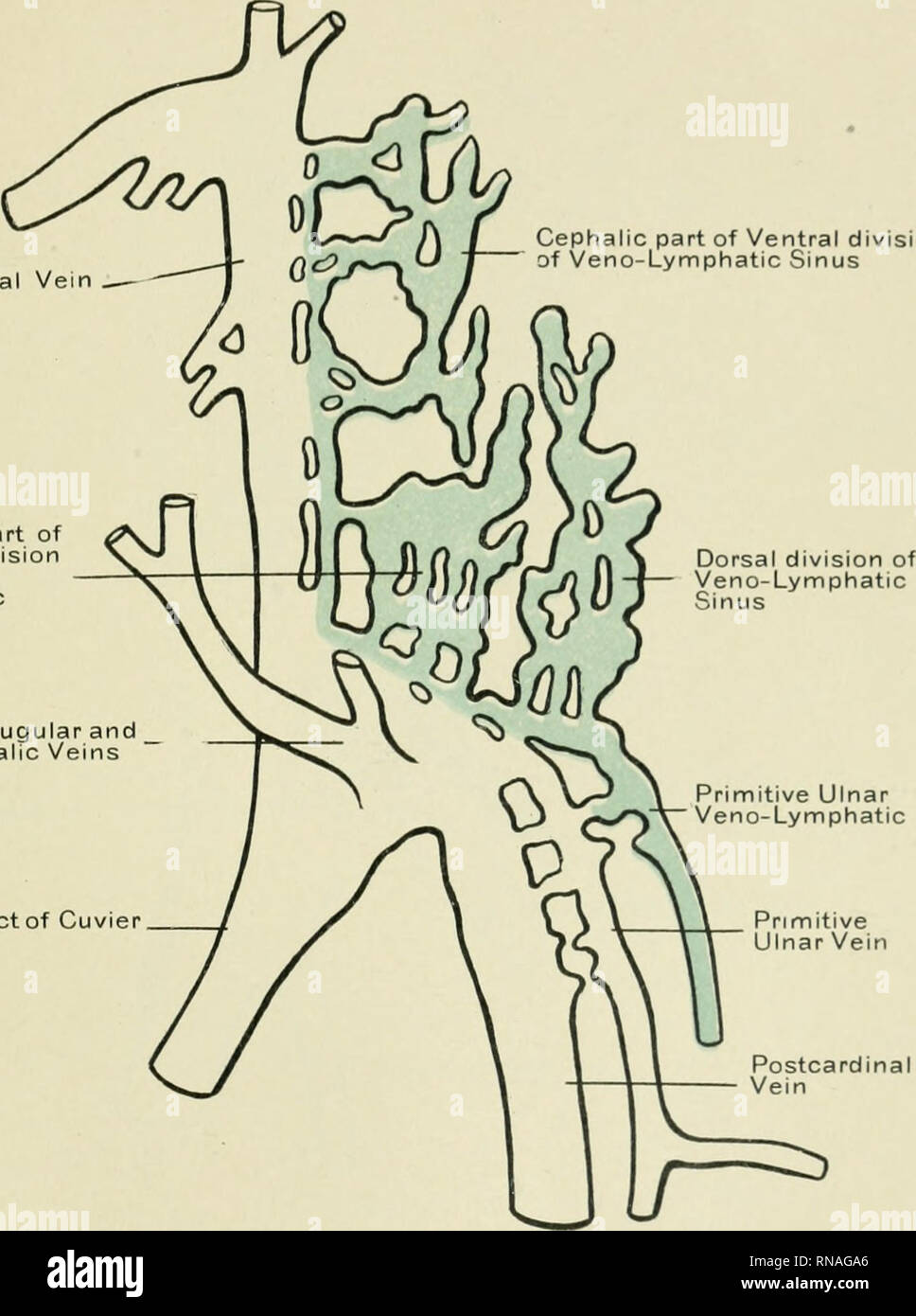 Lymphatic sinus hi-res stock photography and images - Alamy