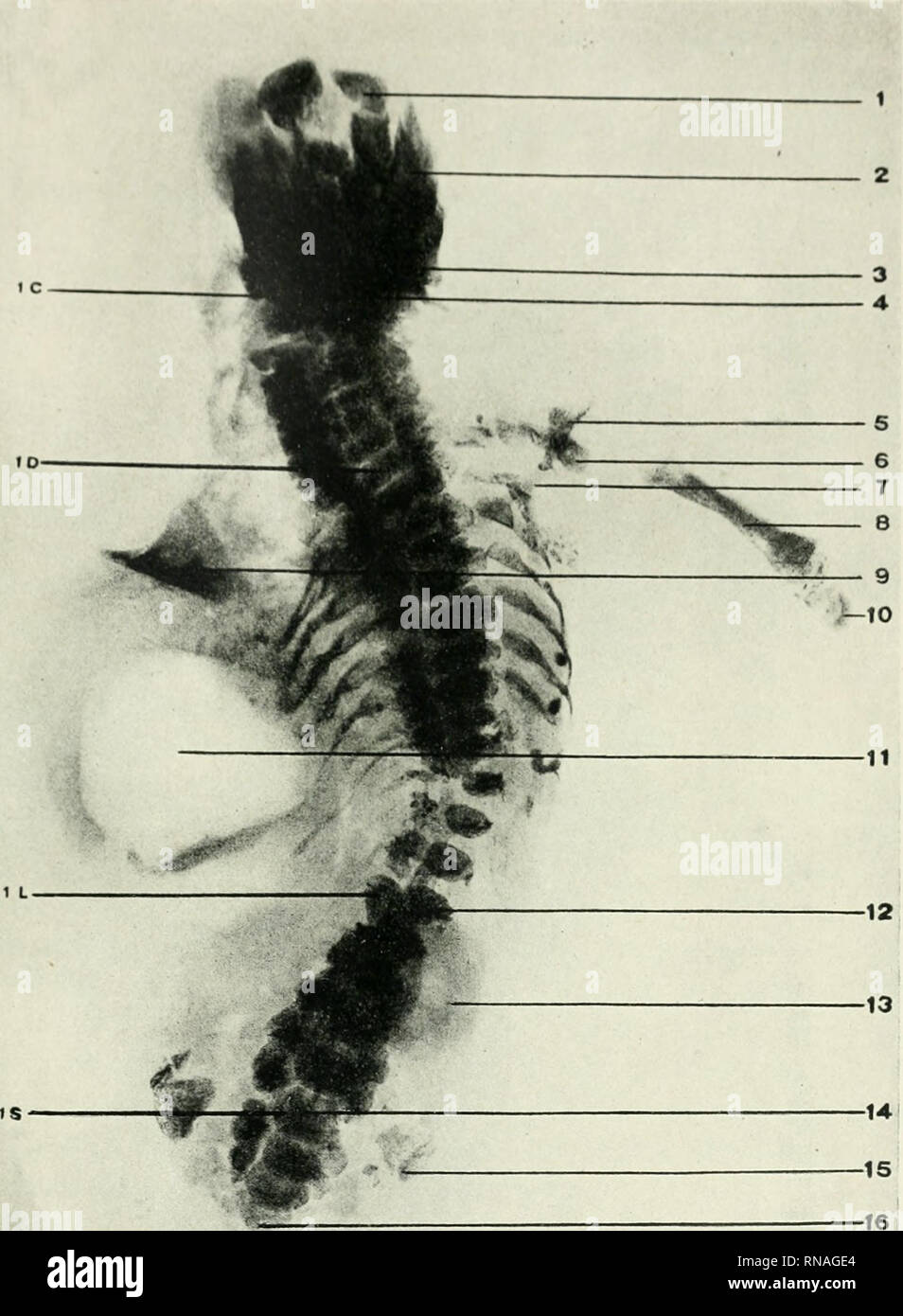 . The anatomical record. Anatomy; Anatomy. Fig. IS Skiagraph No. 1 ...