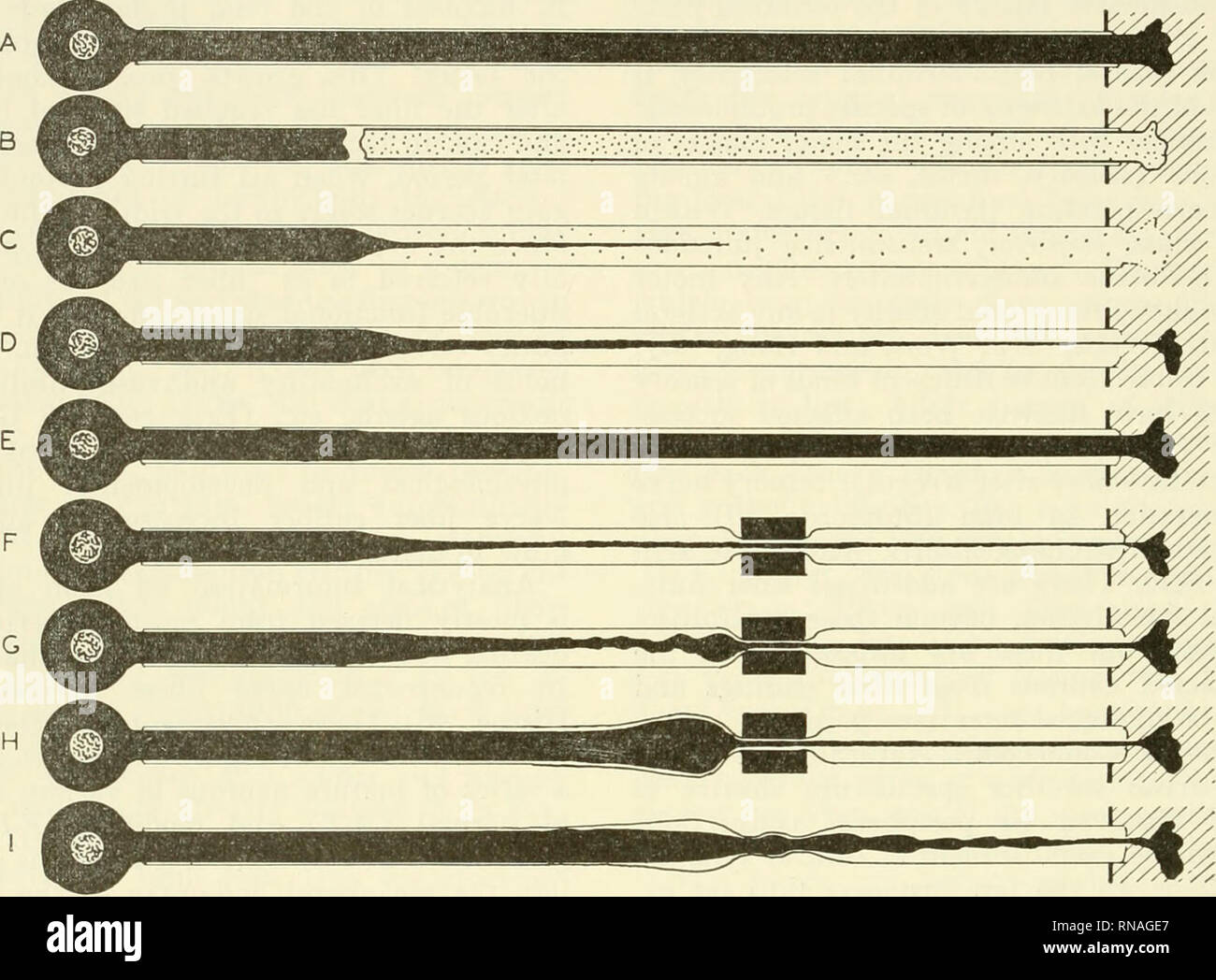 Axonal terminal hi-res stock photography and images - Alamy