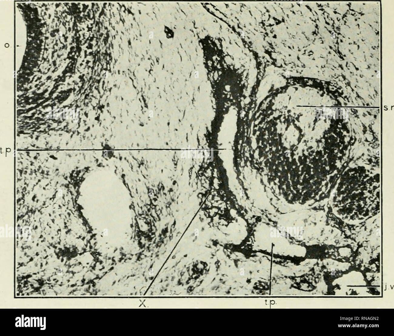 Transverse cervical nerve hi-res stock photography and images - Alamy