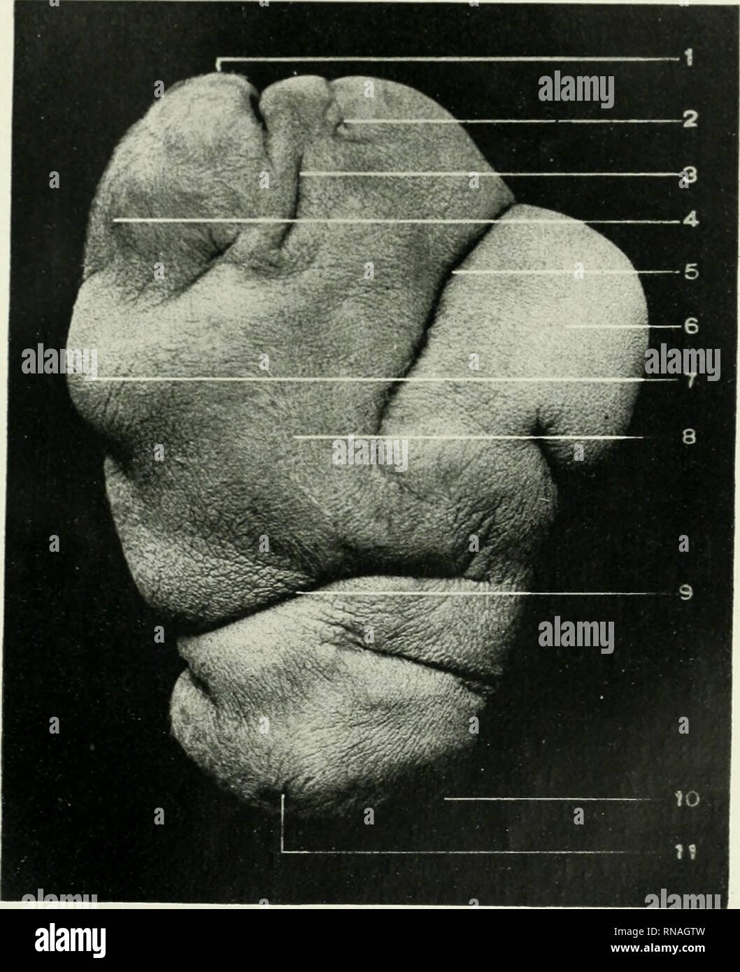 Distorted anatomy hi-res stock photography and images - Alamy