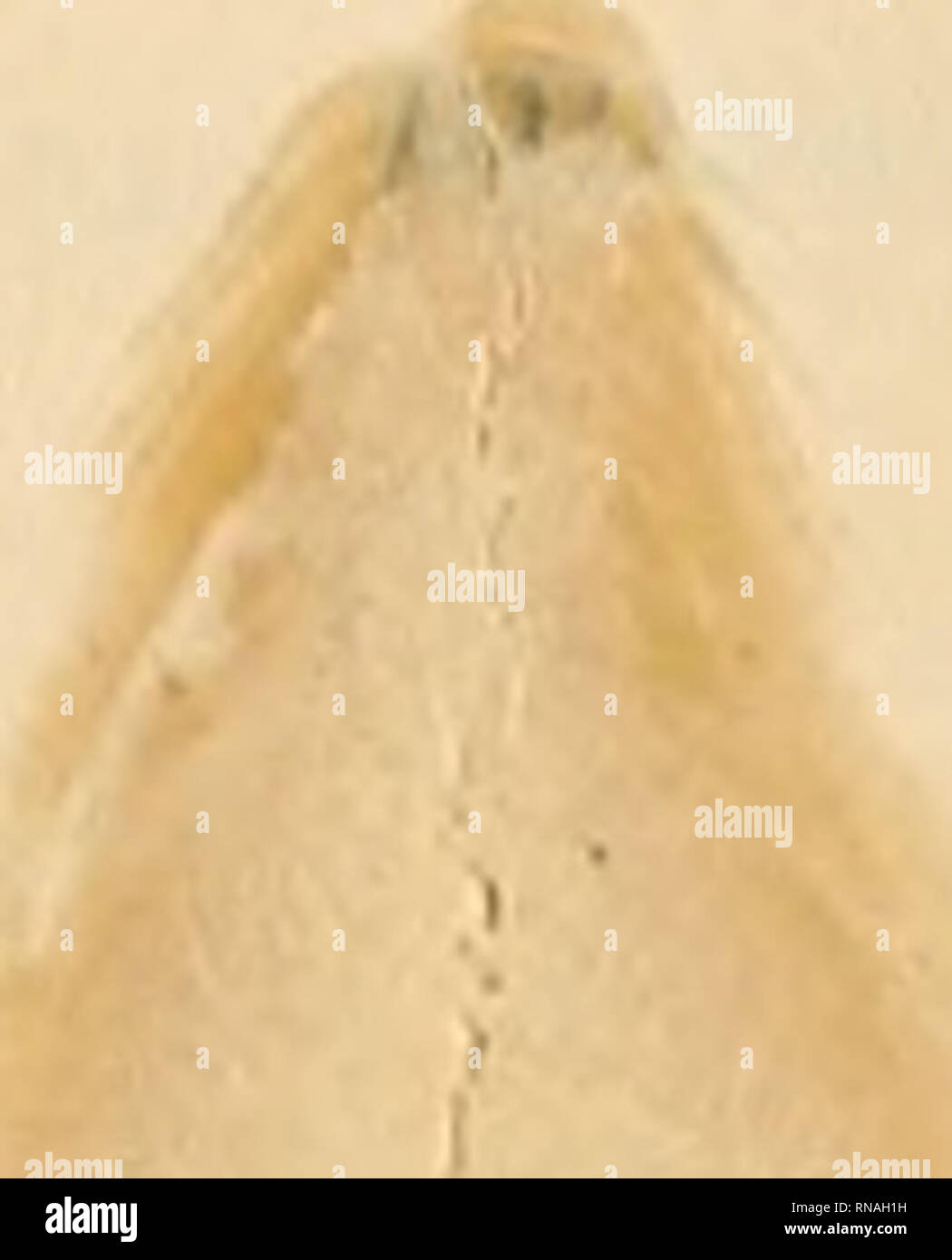 Root of mesentery hi-res stock photography and images - Alamy