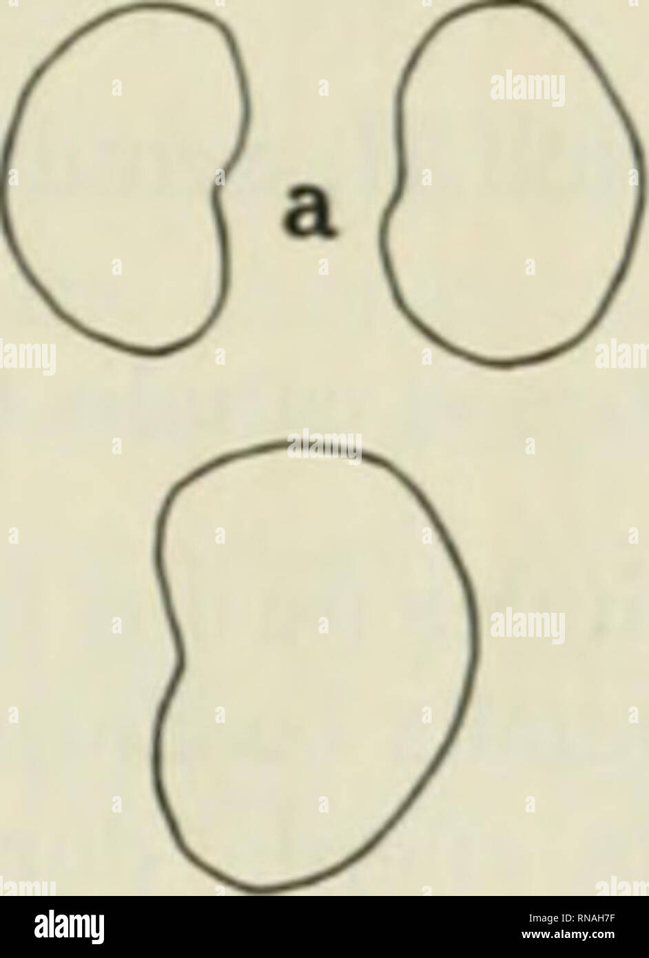 . The anatomical record. Anatomy; Anatomy. ABSENCE OF ONE KIDNEY IN ...