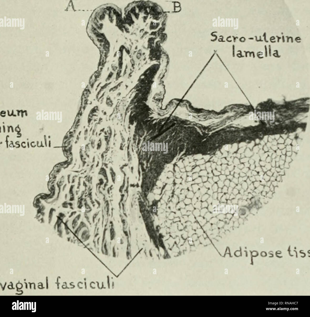 . The anatomical record. Anatomy; Anatomy. THE SACRO-UTERINE LIGAMENTS ...
