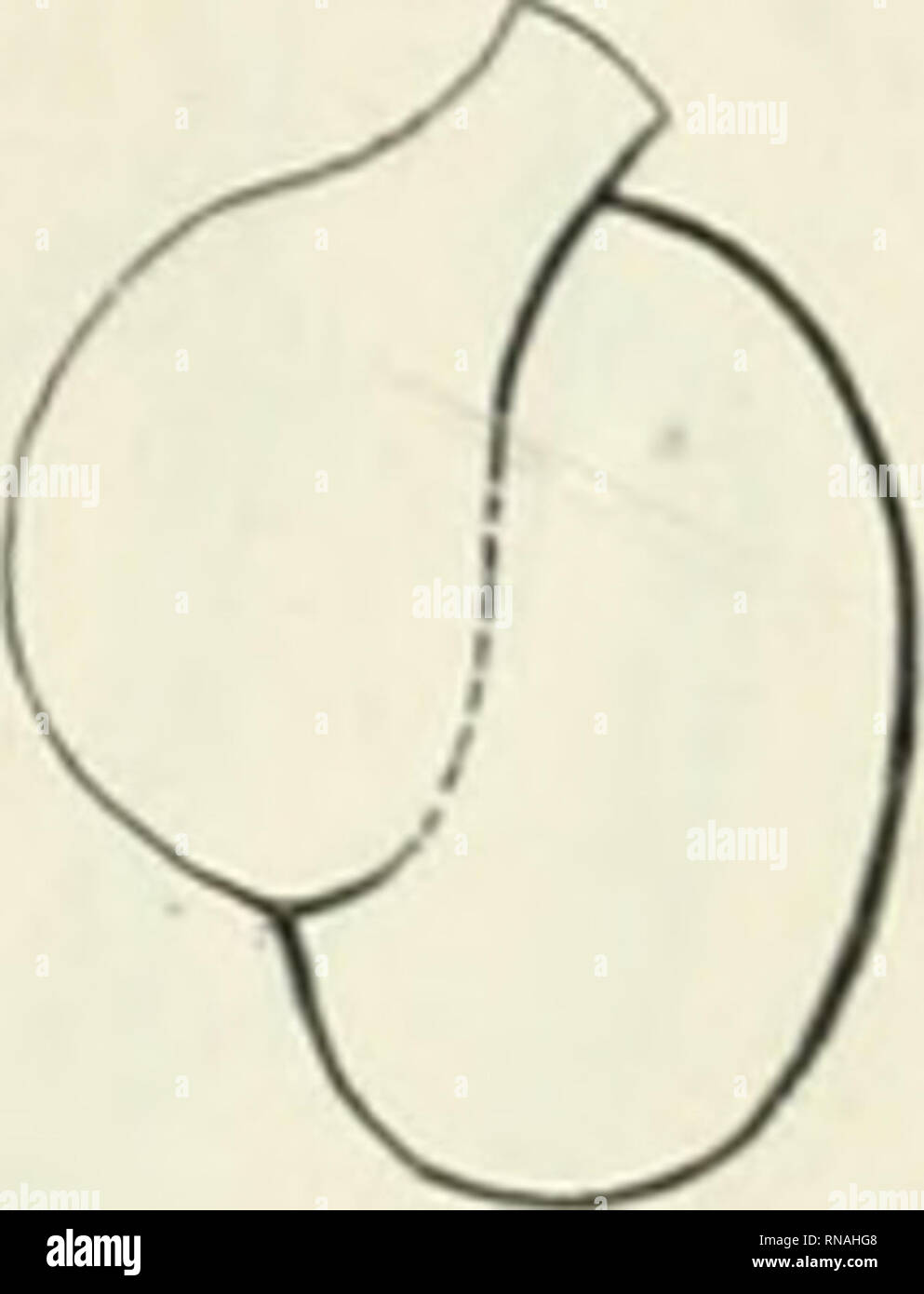 Human heart removed hi-res stock photography and images - Alamy