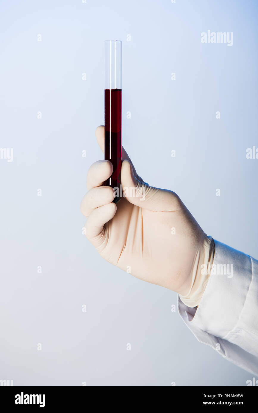 White test tube flask blood hi-res stock photography and images - Alamy