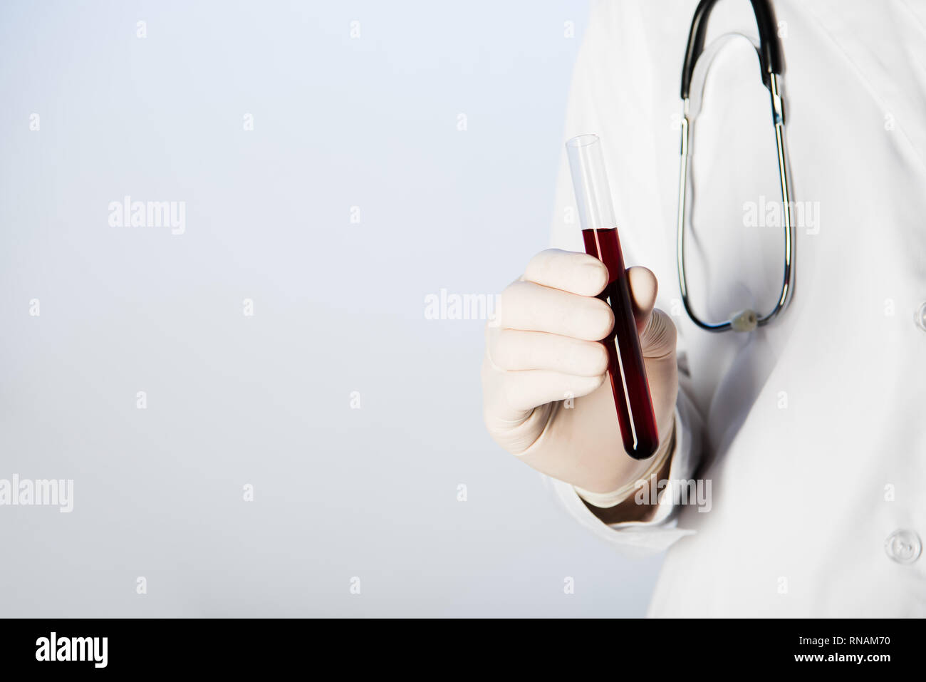 Partial view of doctor with stethoscope holding test tube with blood ...