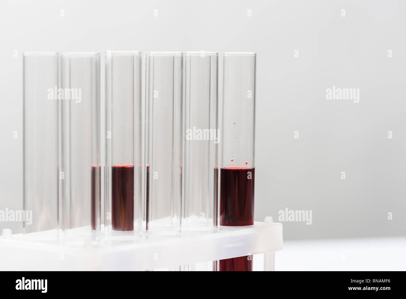 Test tubes with blood on grey background Stock Photo - Alamy