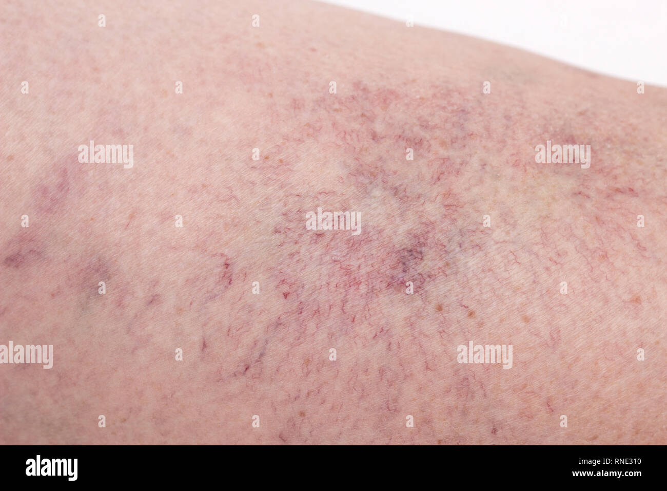 Vascular pattern hi-res stock photography and images - Alamy