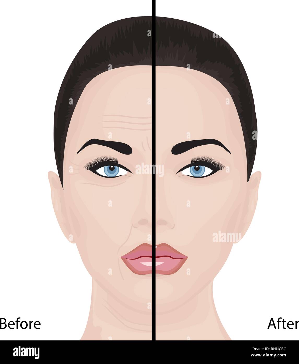 Aging face lifting wrinkles treatment facelift rejuvenation cosmetology ...