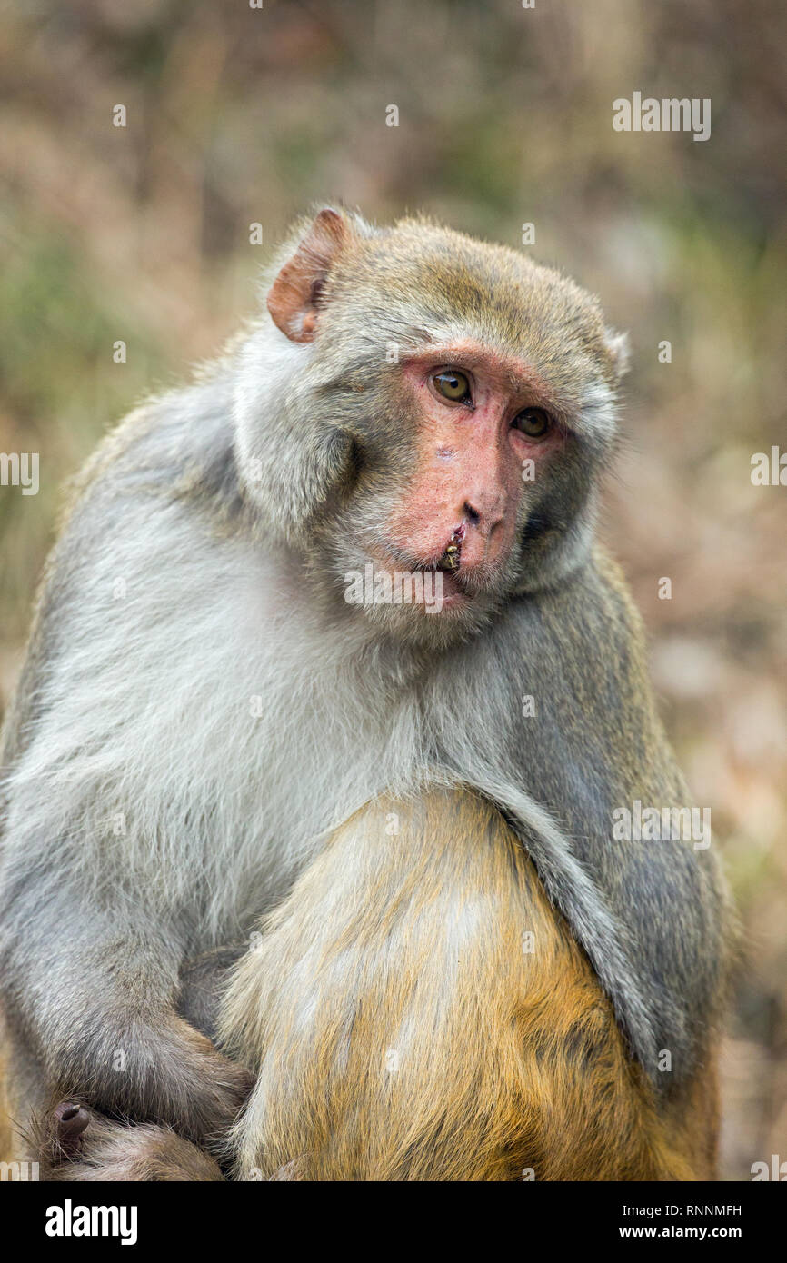 Head and shoulders injured hi-res stock photography and images - Alamy